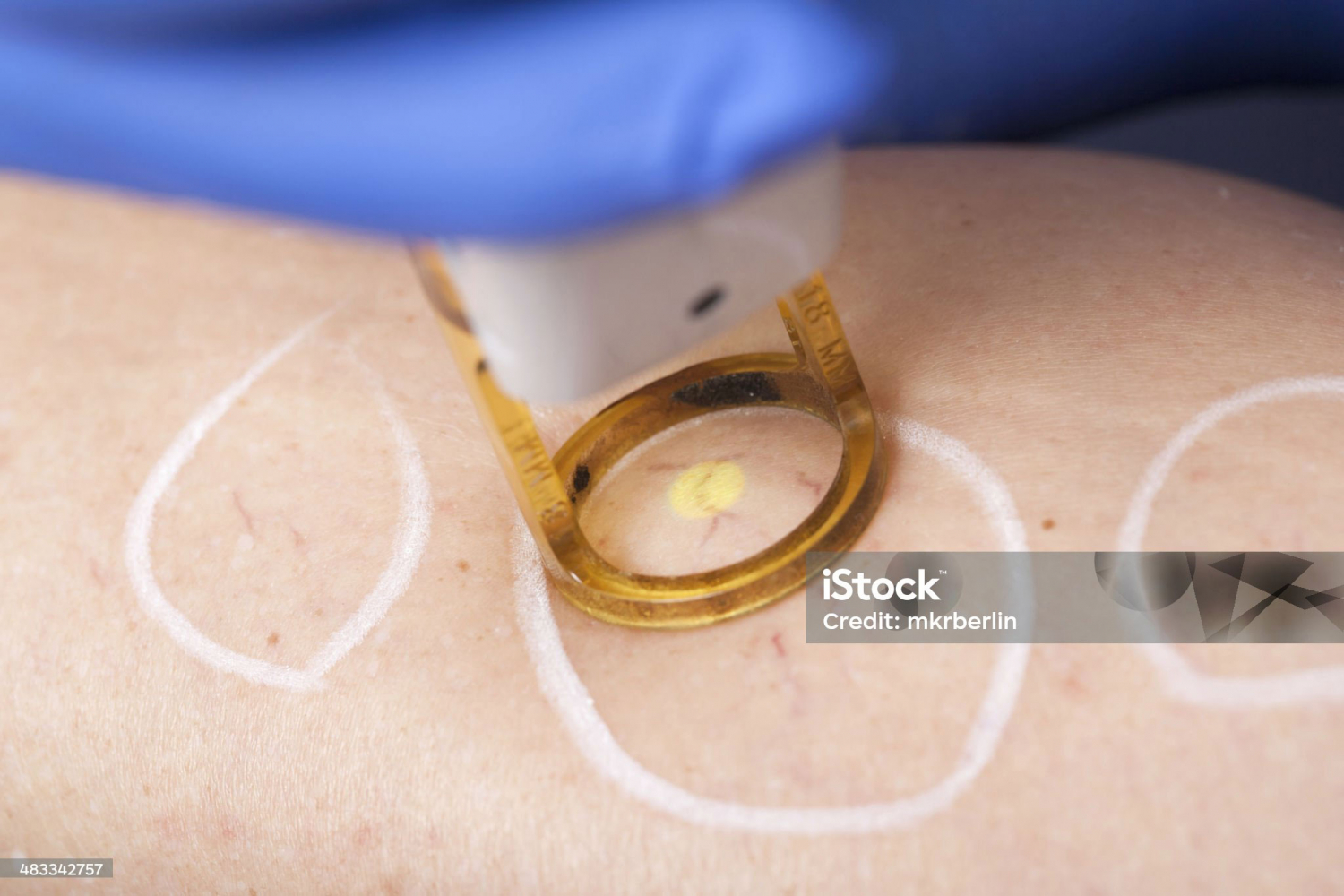 Phlebologie Venenerkrankungen - Gemeinschaftspraxis für Urologie ...